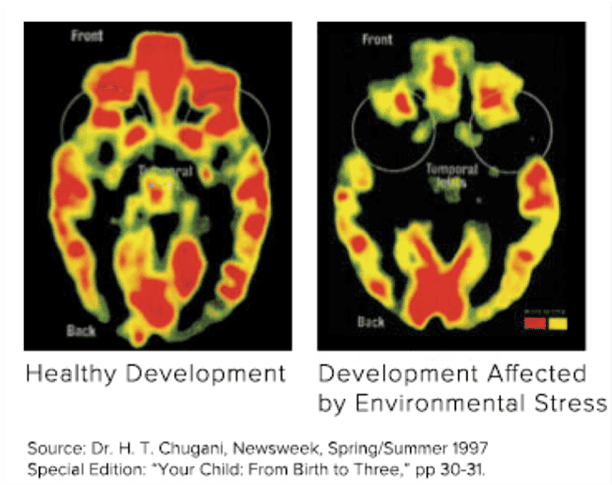 Violence in Childhood – The Early Years — Cure Violence Global